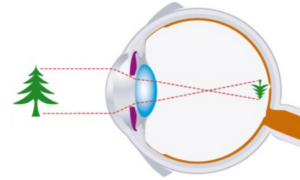 Mechanism of Vision explained - Eyetrraction